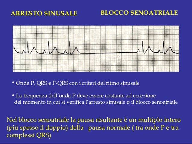 Ripetizioni di elettrocardiografia