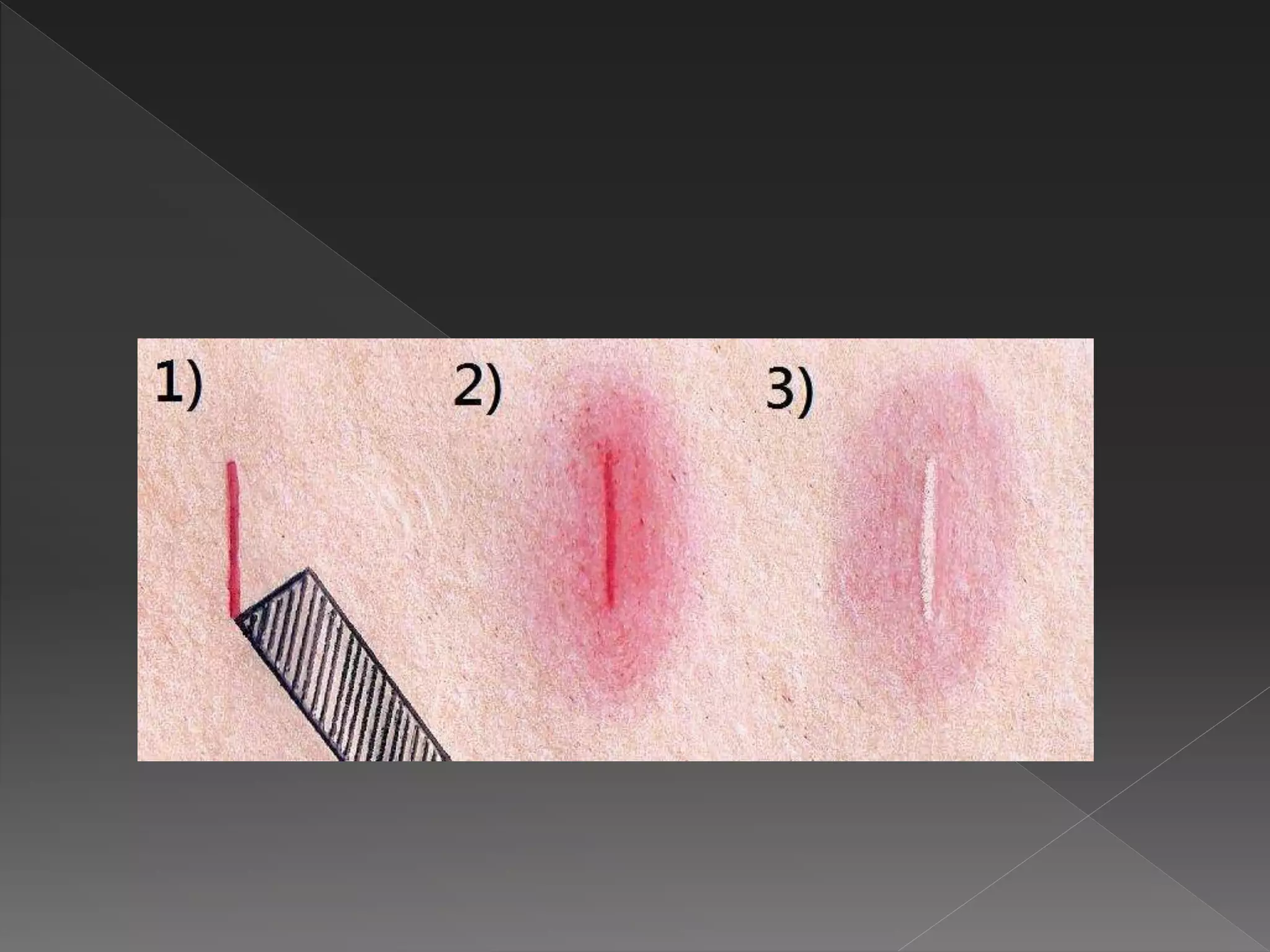 Cutaneous circulation & splanchnic circulation | PPTX