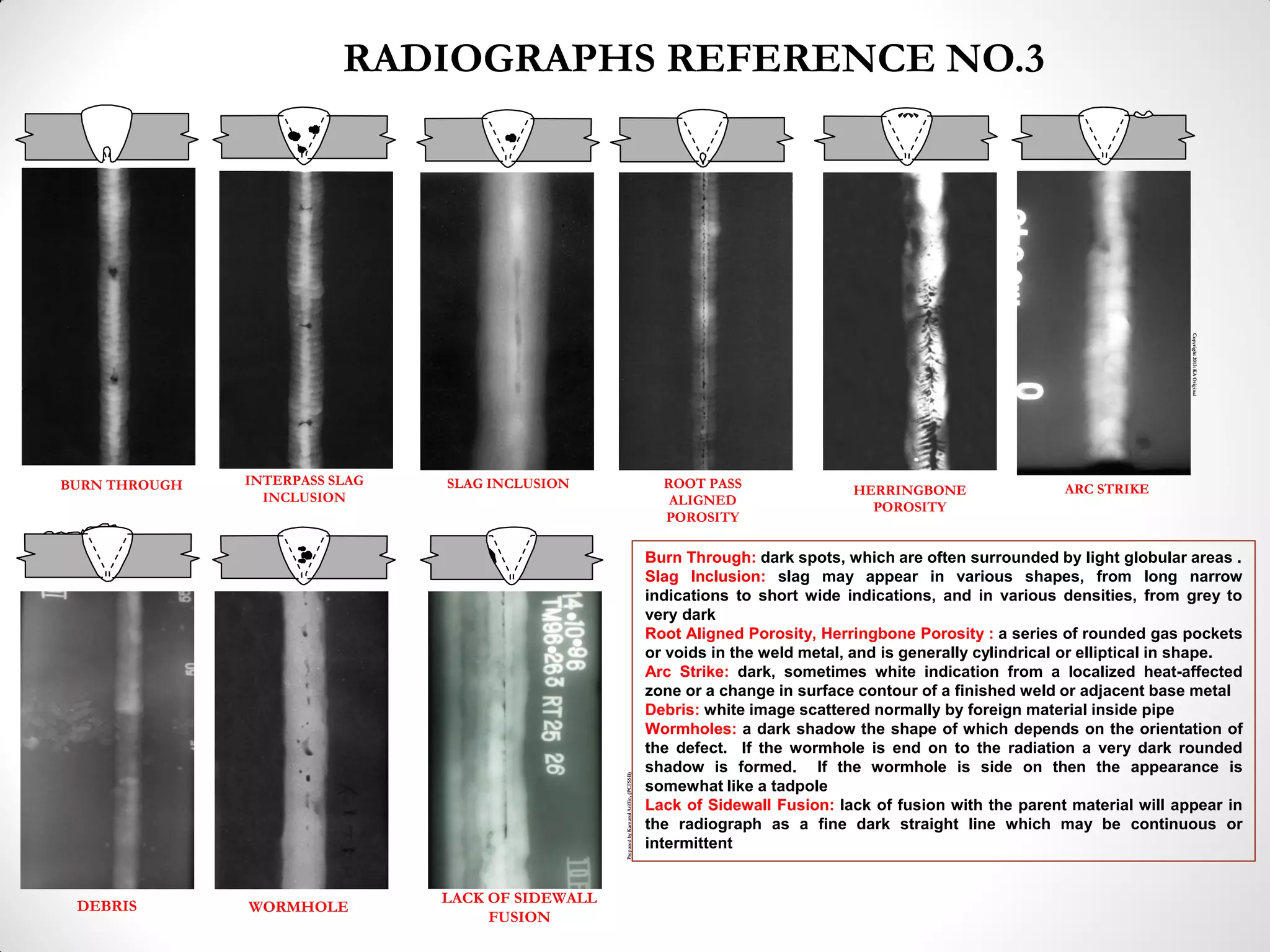 Radiographic interpretation | PDF