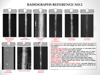 Radiographic interpretation | PDF