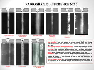 Radiographic interpretation | PDF