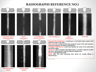 Radiographic interpretation | PPT