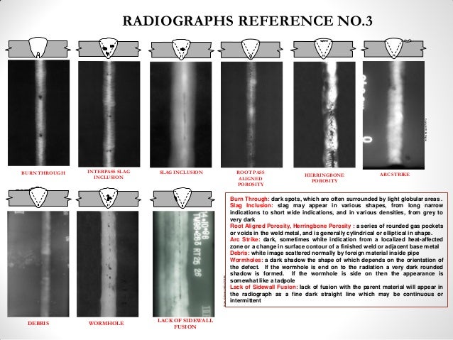 Radiographic interpretation