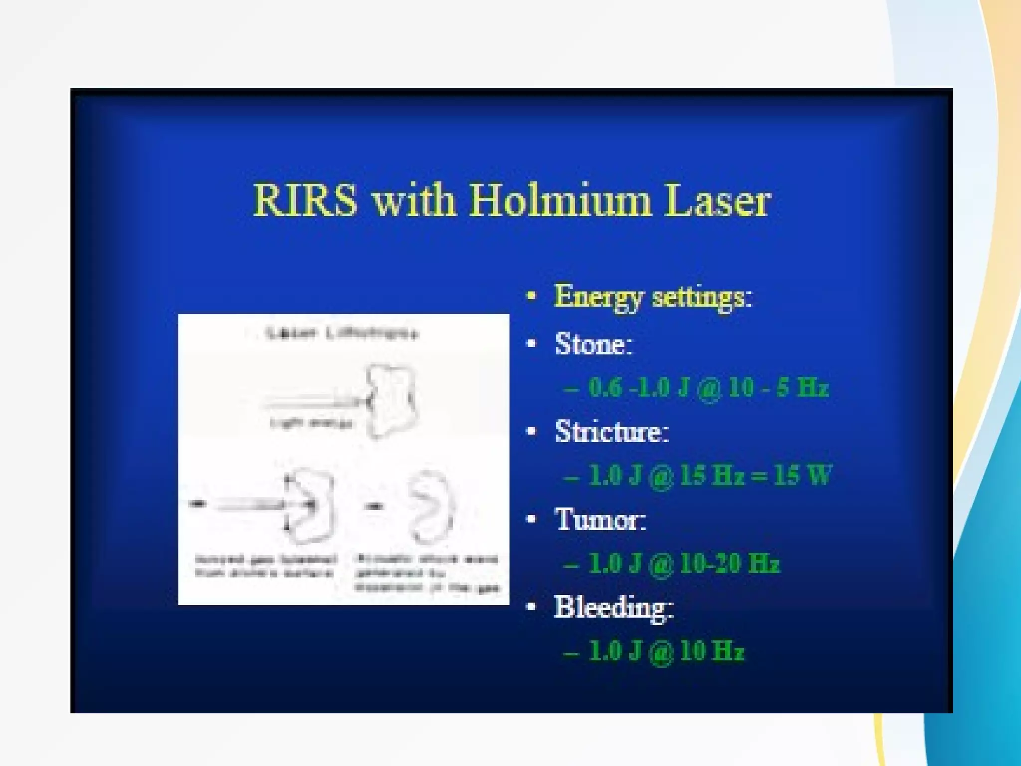 Flexible Uretero-renoscopy or RIRS | PPT