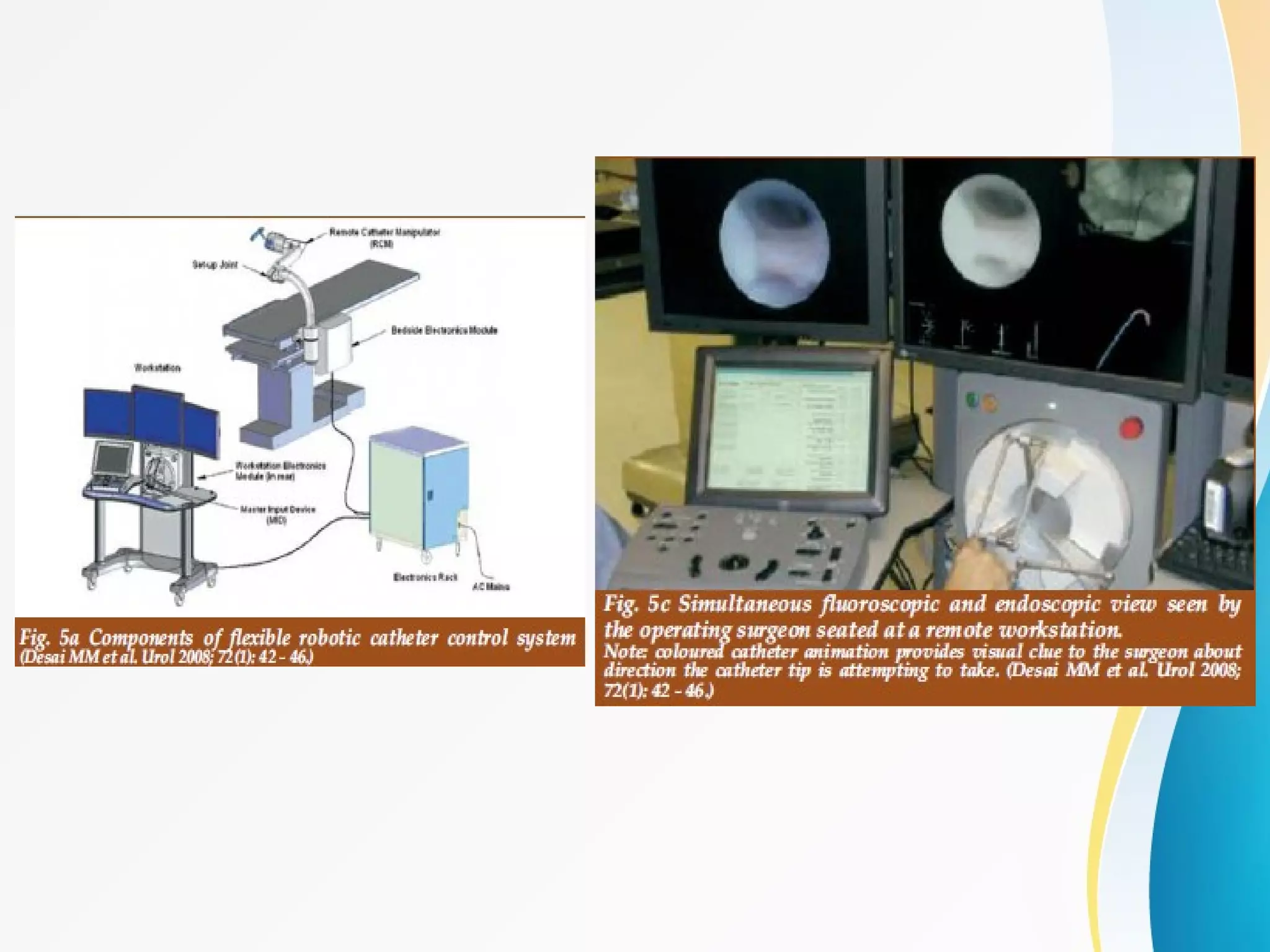 Flexible Uretero-renoscopy or RIRS | PPT