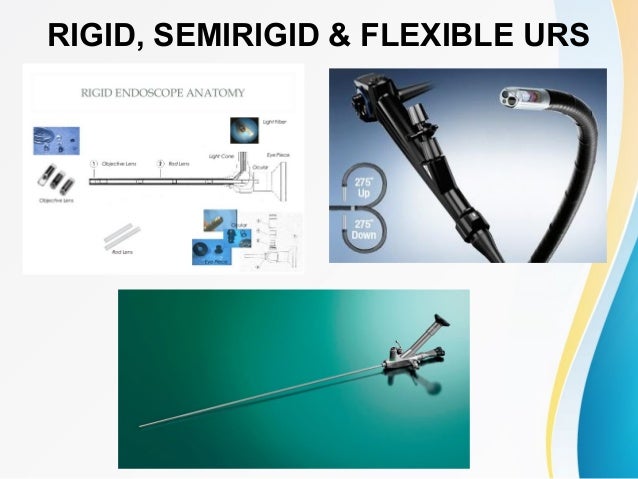 Ureterorenoscopy Definition