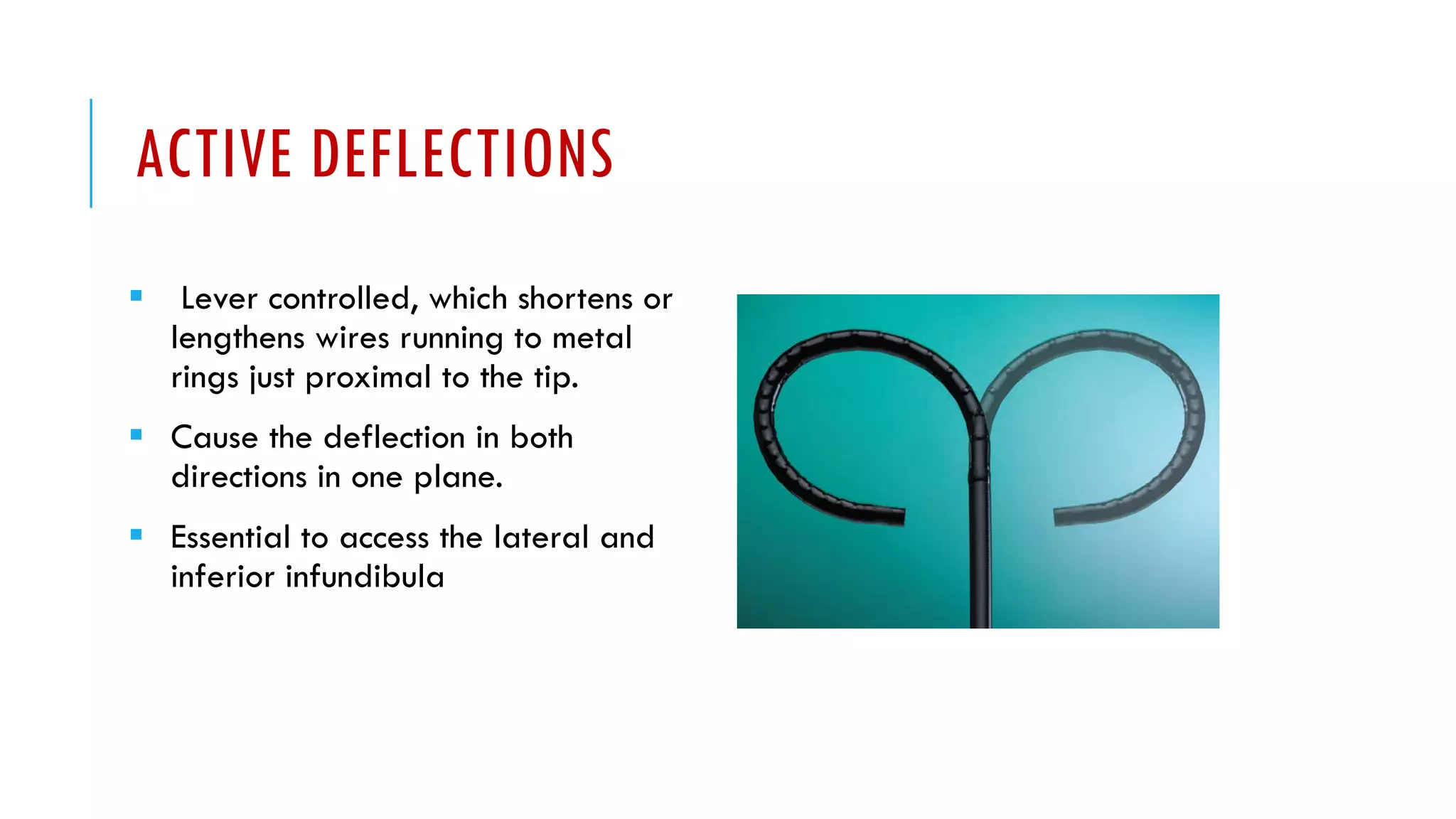 Flexible ureteroscopy and RIRS | PDF