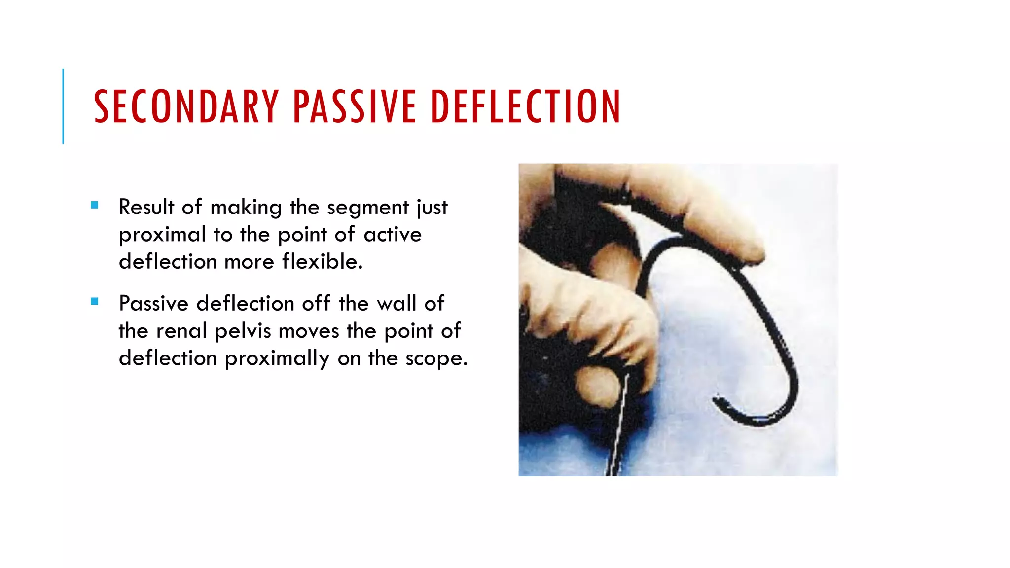 Flexible ureteroscopy and RIRS | PDF