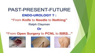 Rirs | PPTX | Surgery | Medical Health