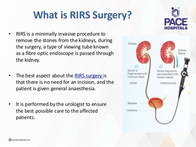 RIRS Surgery - Procedure & Benefits | PDF