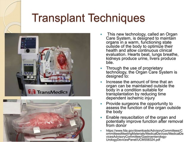 Transplantation of organ types and techniques | PPTX