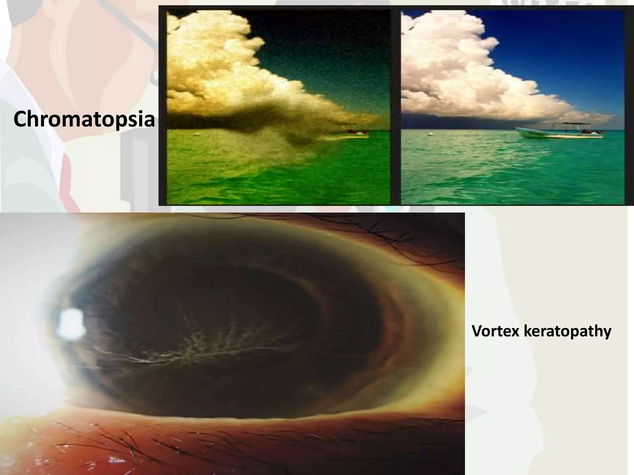 DRUGS IN OPHTHALMOLOGY | PPTX