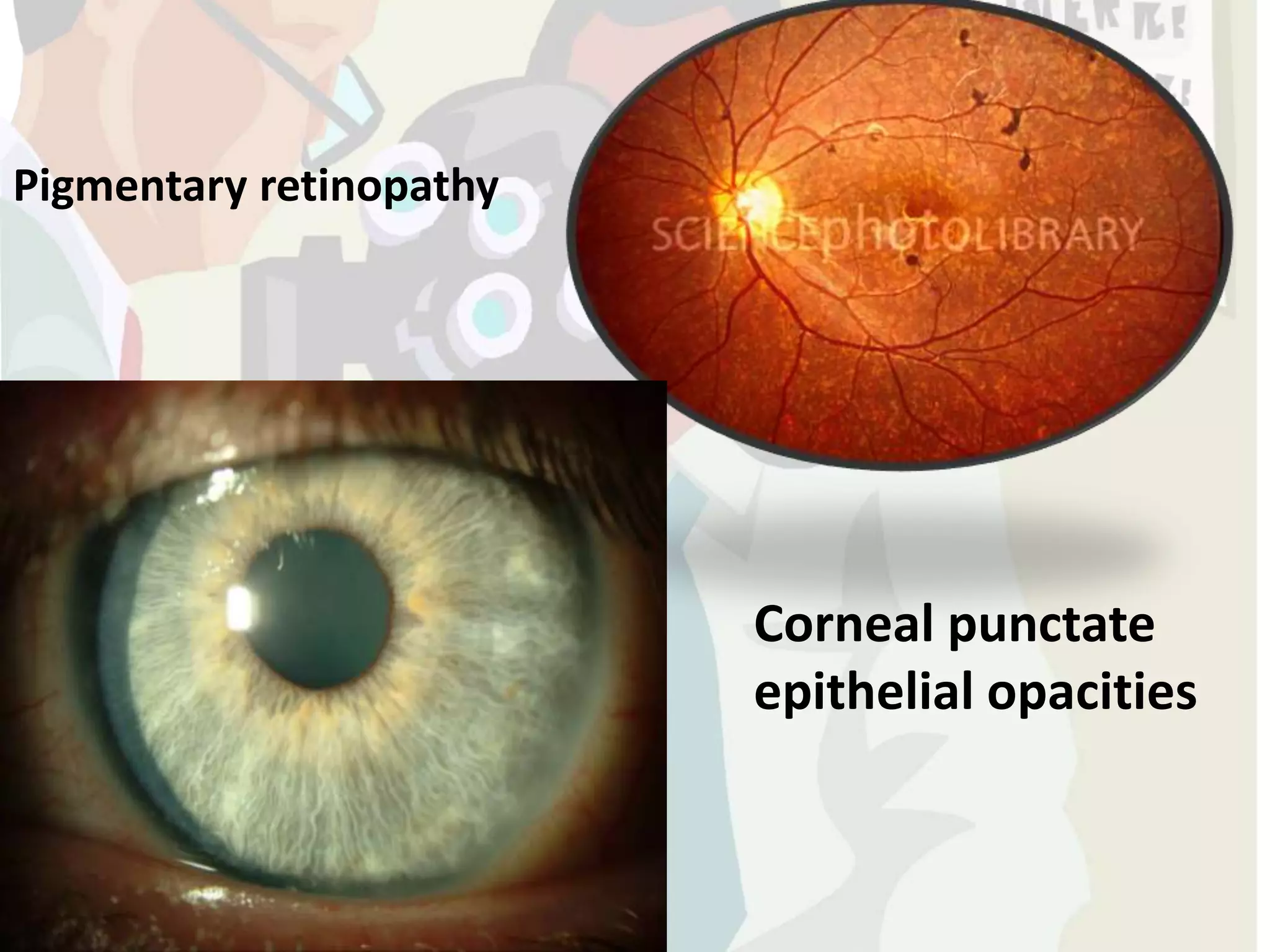 DRUGS IN OPHTHALMOLOGY | PPTX