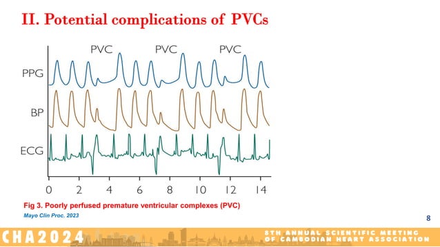 Risk Assessment and Management of PVC.pdf