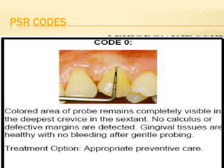 Risk factors and risk assessment of periodontal disease. | PPTX
