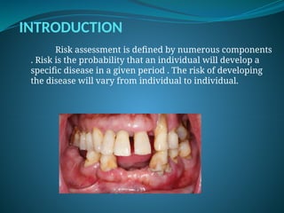RISK FACTORS FOR PERIODONTAL DISEASE.pptx