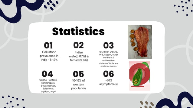 Gallstones (Cholelithiasis) Lifestyle, Risk factors, preventions.pdf