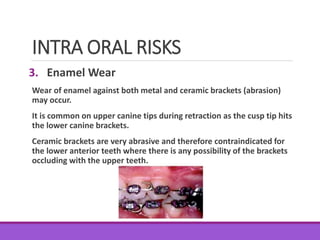 Risks in Orthodontic Treatment | PPTX