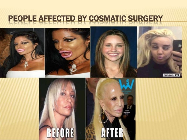 Risks in plastic surgery