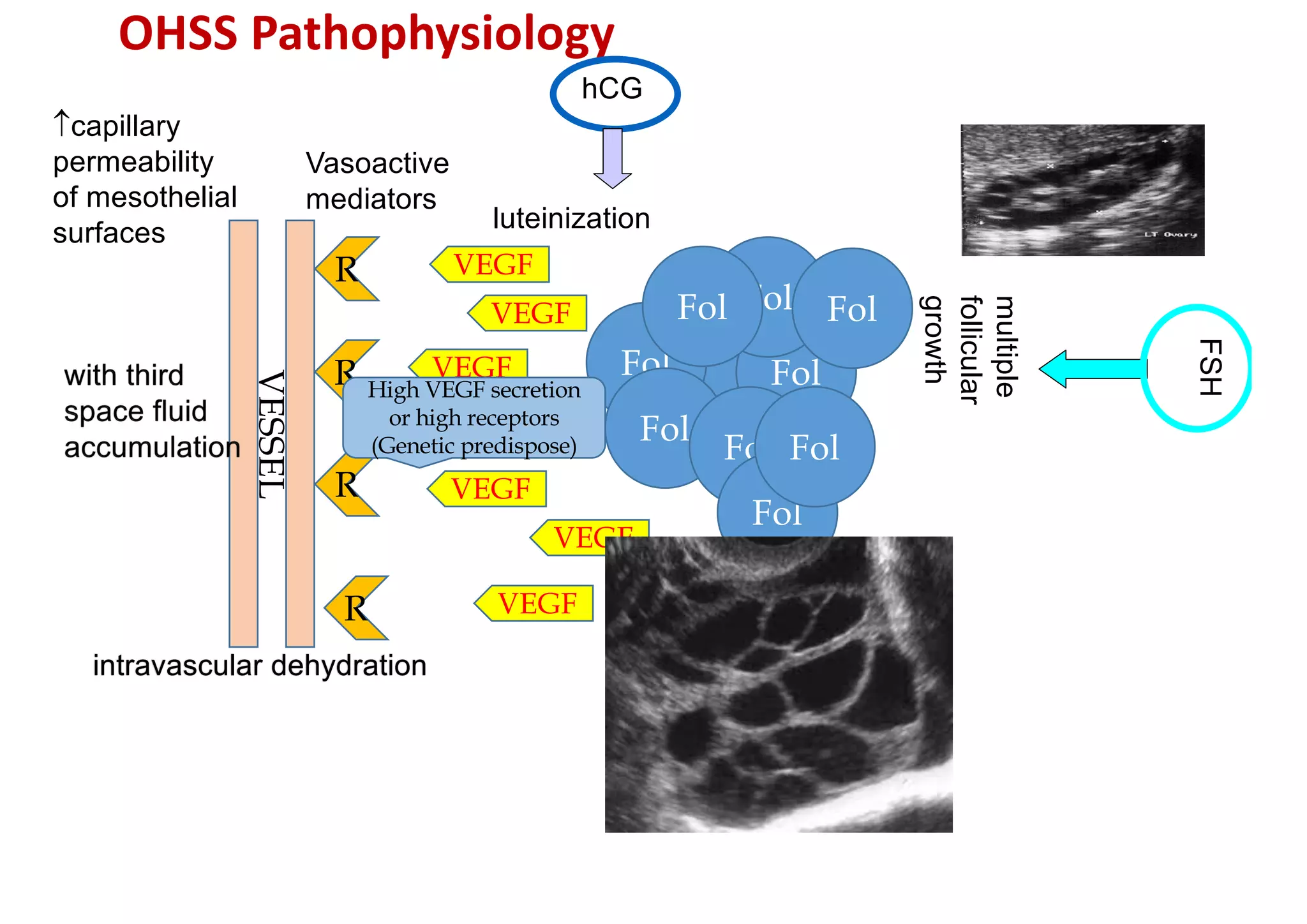 Risks of ivf | PPT