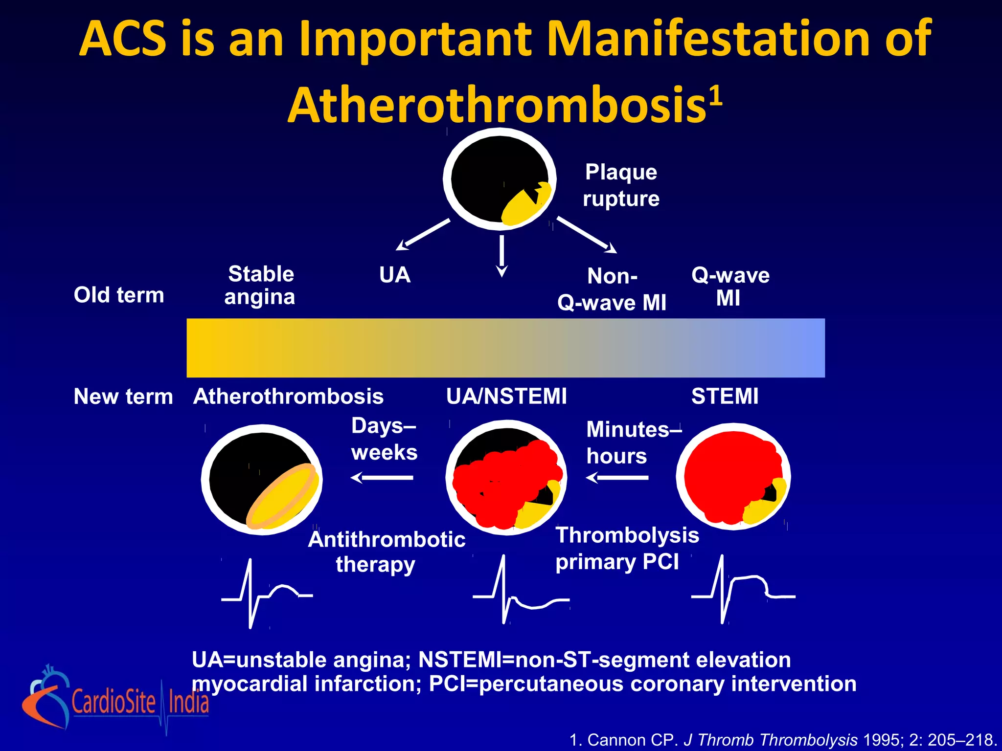 Risk stratification in UA and NSTEMI: Why and How? | PPT