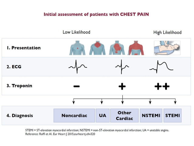 Risk stratification of UA & NSTEMI | PPT