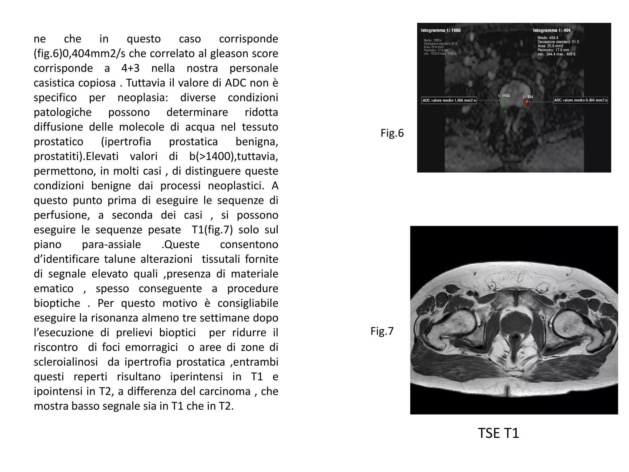 Risonanza magnetica multiparametrica della prostata(tecnica d’esame) | PDF
