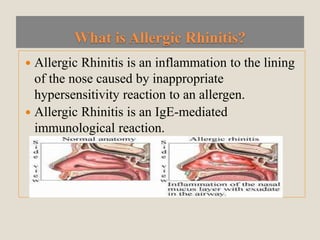 Allergic Reaction | PPTX