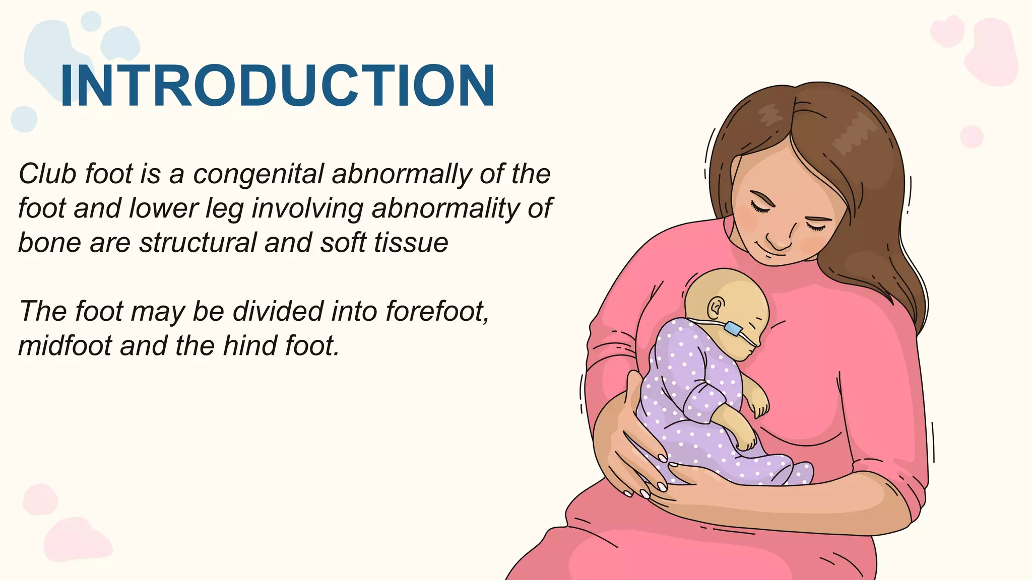 Club foot in Child | PPTX