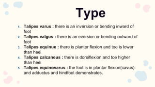 Club foot in Child | PPTX