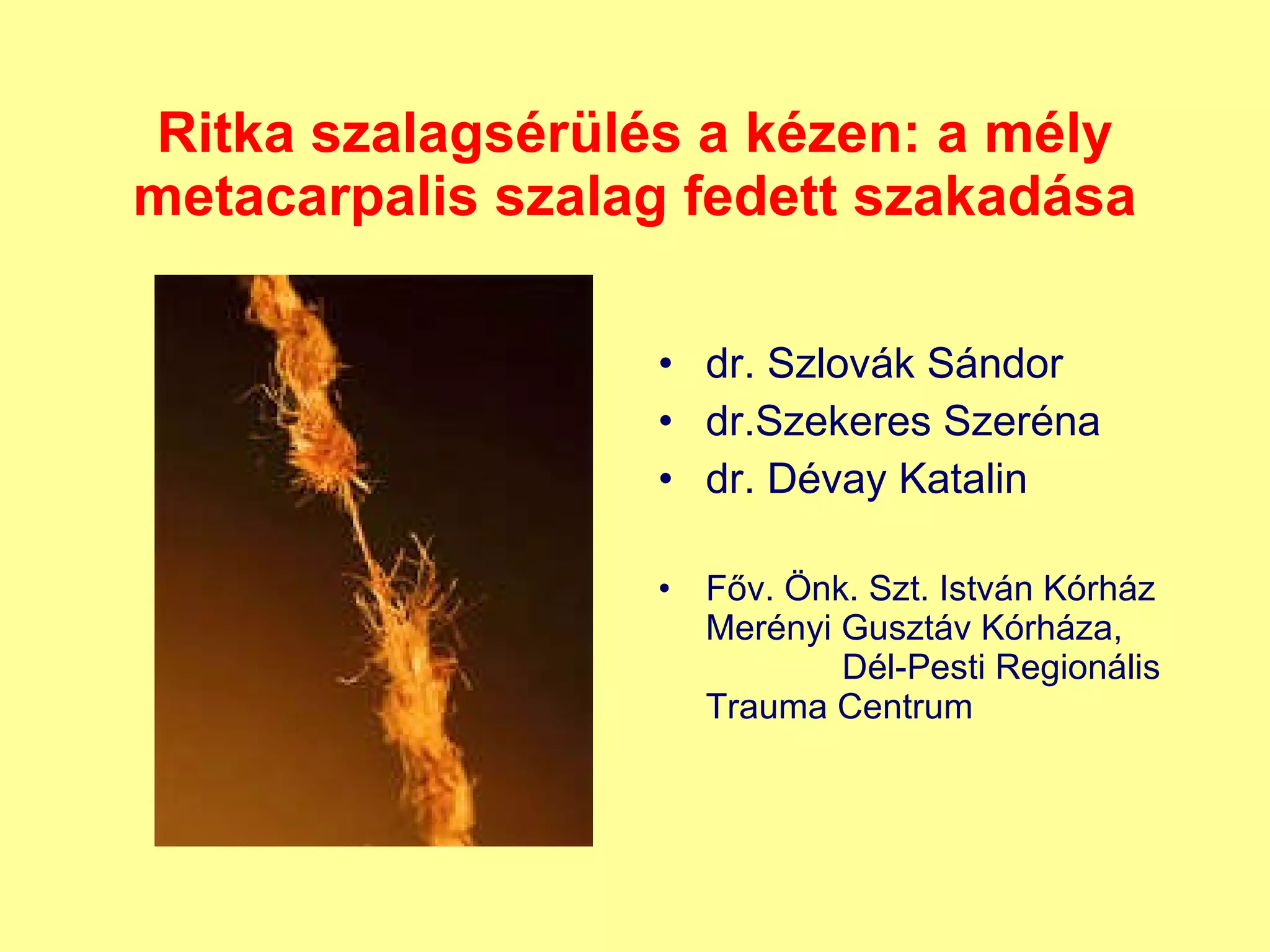 Rare ligamental (DTML) hand injury (oral presentation); 2nd award for ...