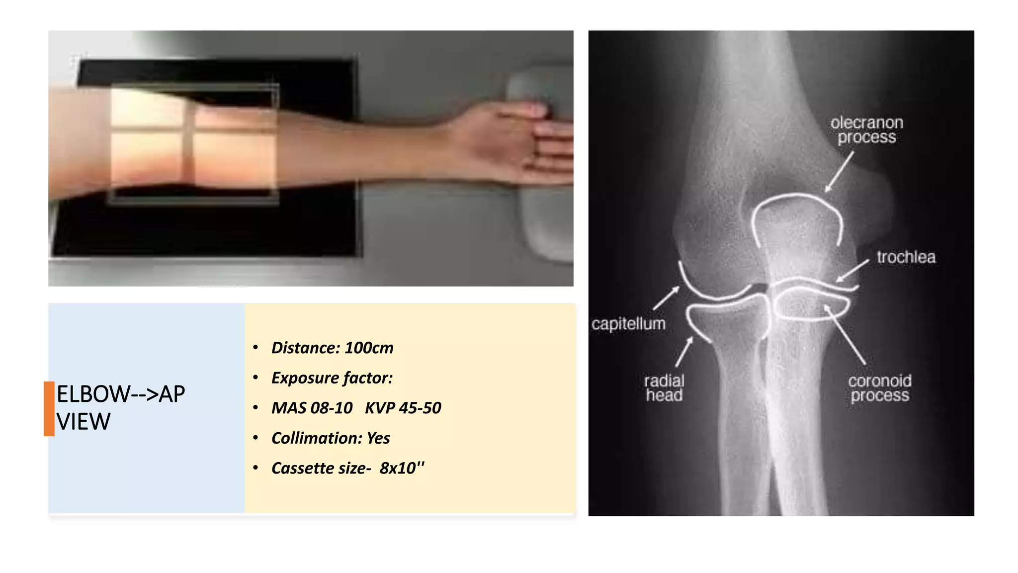 Radiographic positioning of Upper limb (ELBOW & HUMERUS) | PPTX