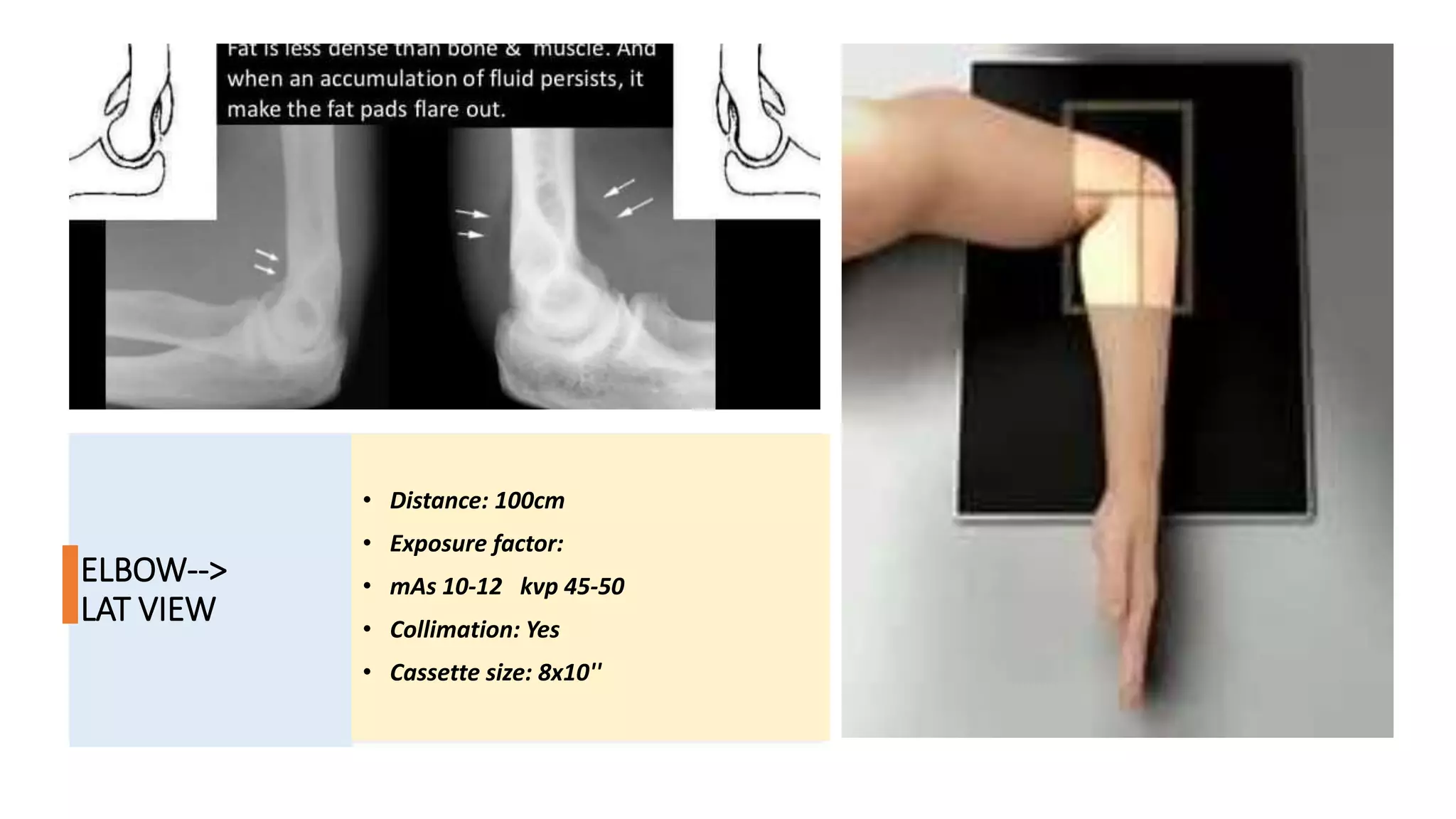 Radiographic positioning of Upper limb (ELBOW & HUMERUS) | PPTX
