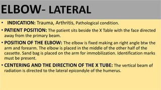 Radiographic positioning of Upper limb (ELBOW & HUMERUS) | PPTX