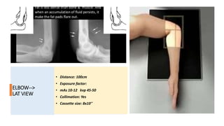 Radiographic positioning of Upper limb (ELBOW & HUMERUS) | PPTX