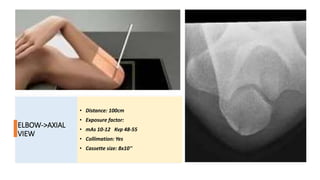 Radiographic positioning of Upper limb (ELBOW & HUMERUS) | PPT