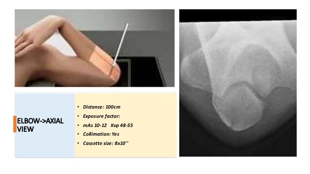 Radiographic Positioning Of Upper Limb Elbow And Humerus