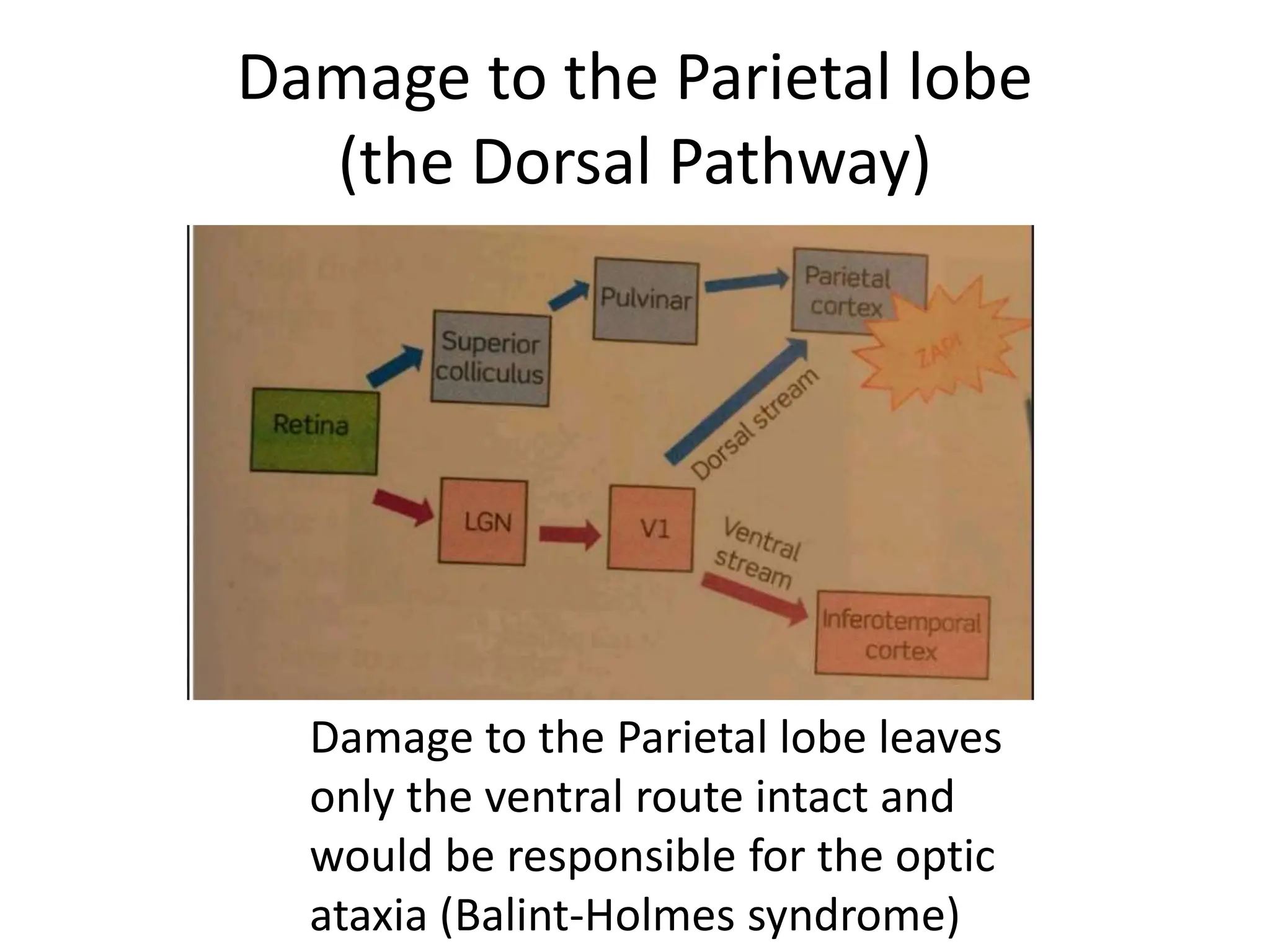 Visual System - the visual pathway basic | PPTX
