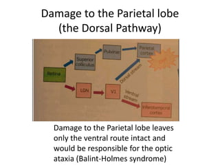 Visual System - the visual pathway basic | PPTX