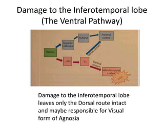 Visual System - the visual pathway basic | PPTX