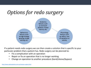 Rivision surgery after laparoscopic sleeve gastrectomy | PPTX