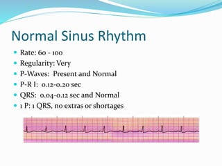 Rizk ecg | PPT