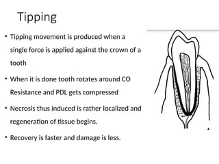 r jc alveolar bone 02-05-2024dvfdgtrgtrg.pptx