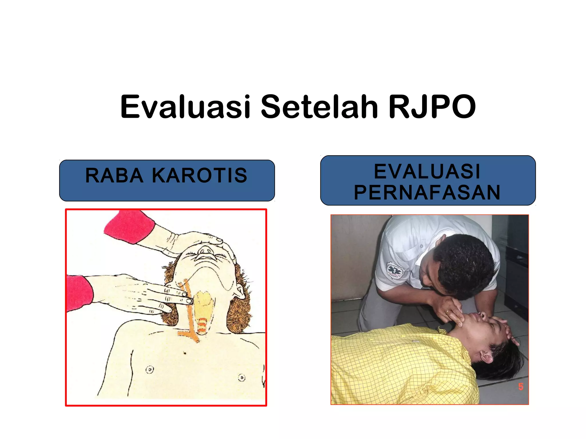 RJPO (Resusitasi Jantung Paru Otak) | PPT