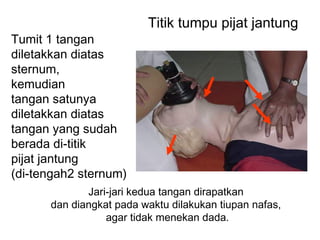 RJPO (Resusitasi Jantung Paru Otak) | PPT