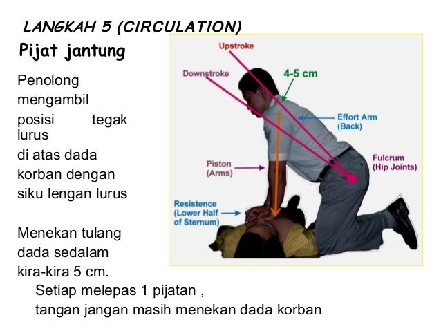 RJPO (Resusitasi Jantung Paru Otak)