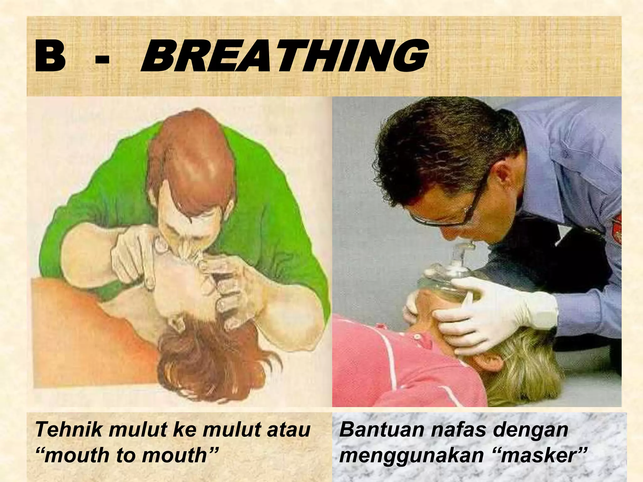 RJP RESUSITASI JANTUNG PARU | PPTX