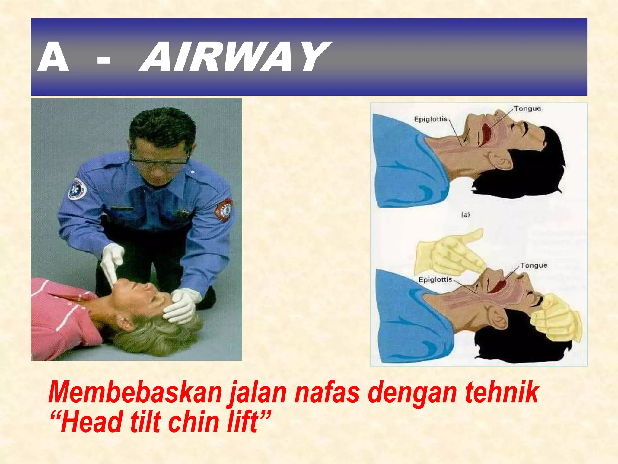 RJP RESUSITASI JANTUNG PARU | PPTX