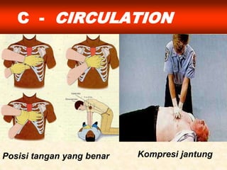 RJP RESUSITASI JANTUNG PARU | PPTX