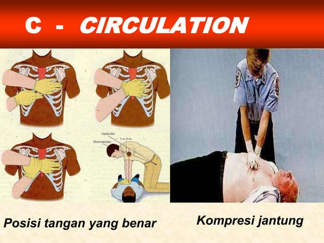 RJP RESUSITASI JANTUNG PARU | PPTX